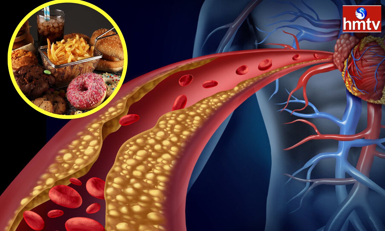 Bad Cholesterol: చెడు కొలస్ట్రాల్‌ని తగ్గించండి.. ఇవి తినడం ఆపకపోతే ఆయుష్షు తగ్గినట్లే ...